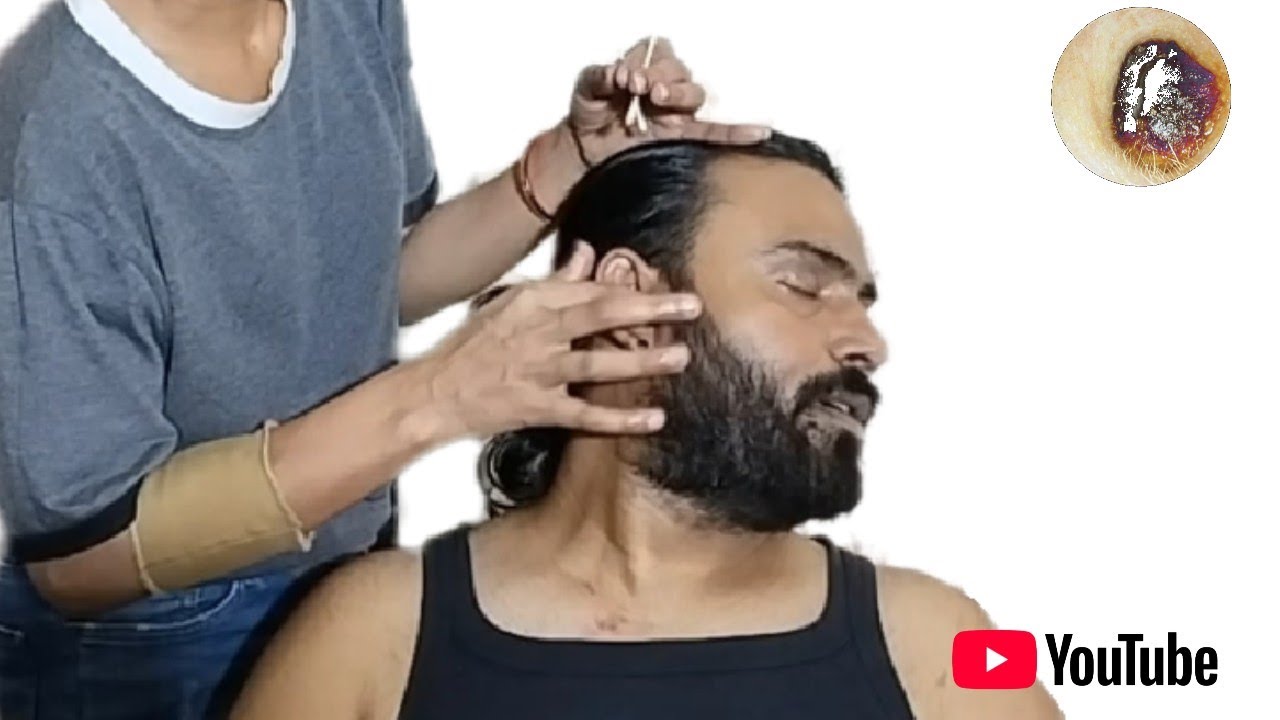 Extreme Oil Ear Cleaning ASMR 🔥 | Deep Massage, Pinching & Scraping ...