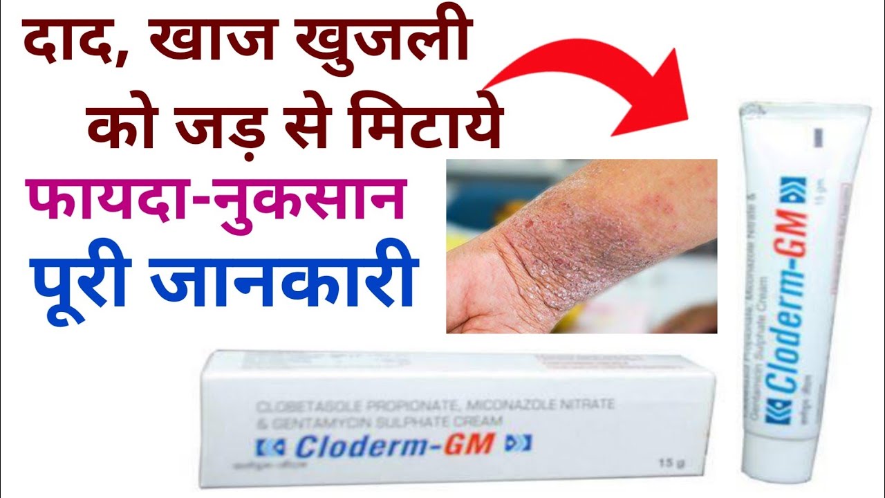 cloderm gm cream uses in hindi | cloderm gm cream ke fayde | cloderm gm ...