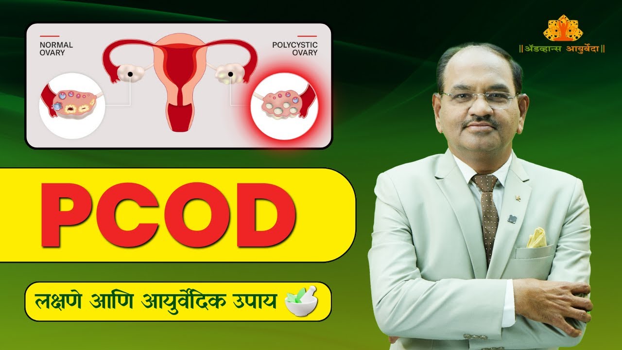 PCOD treatment in Ayurveda | PCOD आयुर्वेदिक उपचार | By Dr. Vidyadhar ...
