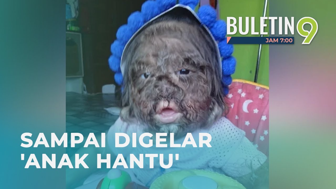 Keunikan Missclyen Kerap Dapat Perhatian - YouTube