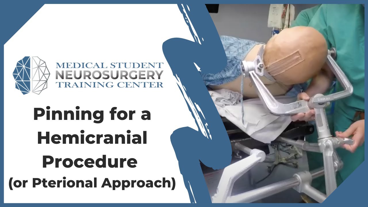 Pinning for a Hemicranial Procedure (or Pterional Approach) - YouTube