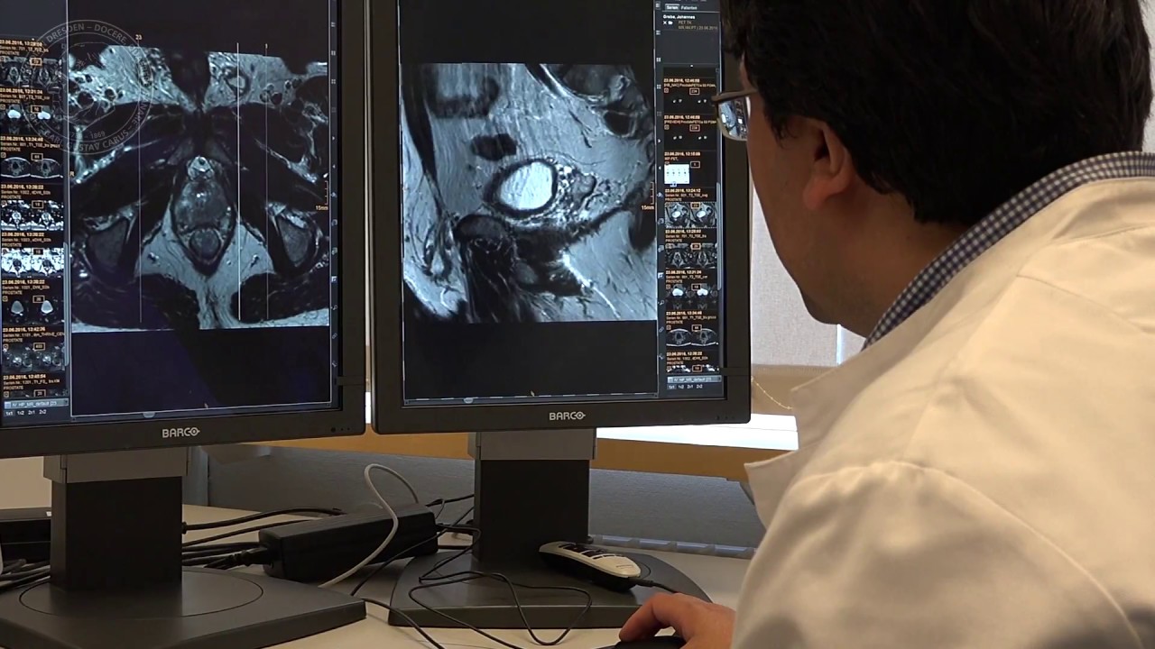 Comparison of multiparametric MRI and MRI/Ultrasound-fusion biospy with ...