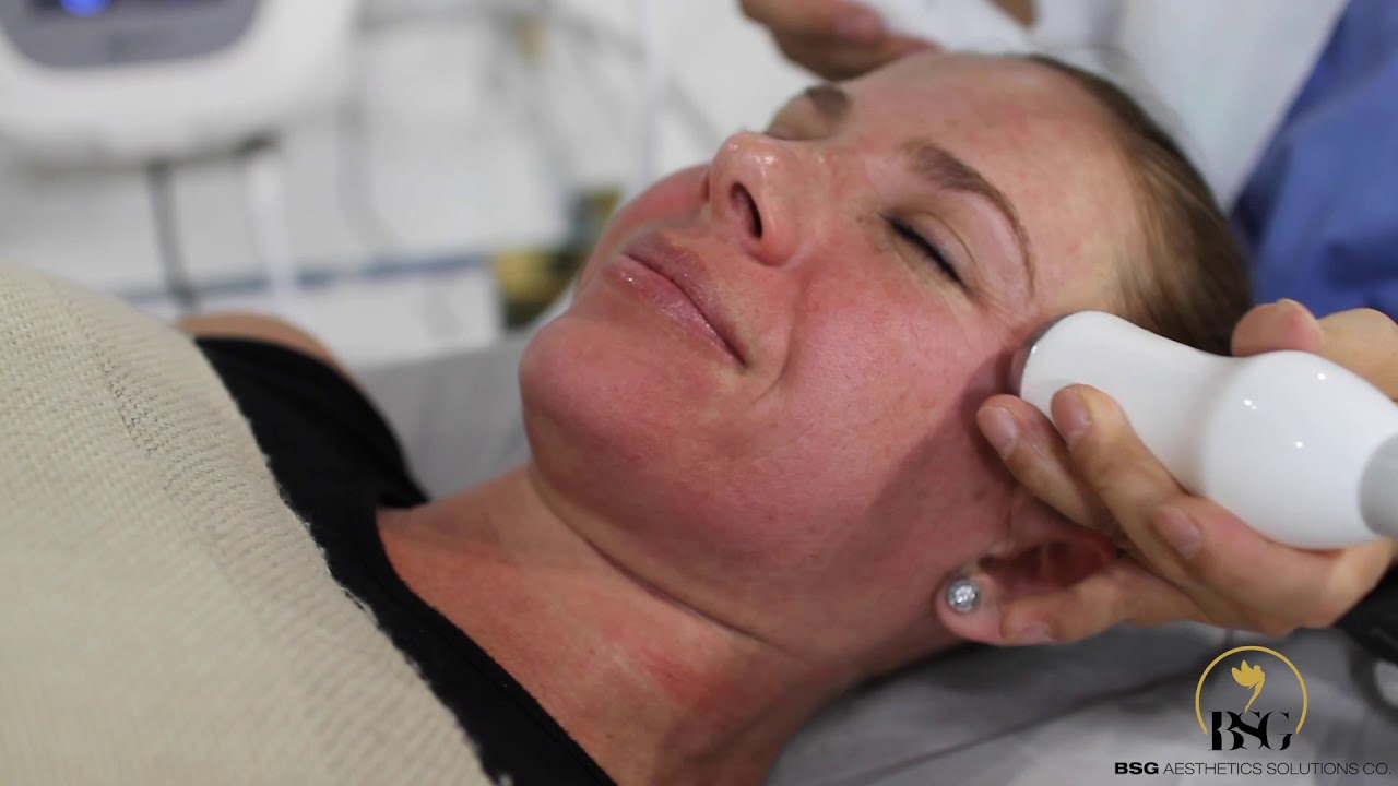 Recell Ice Demo and Promo Video (Microneedling) - YouTube