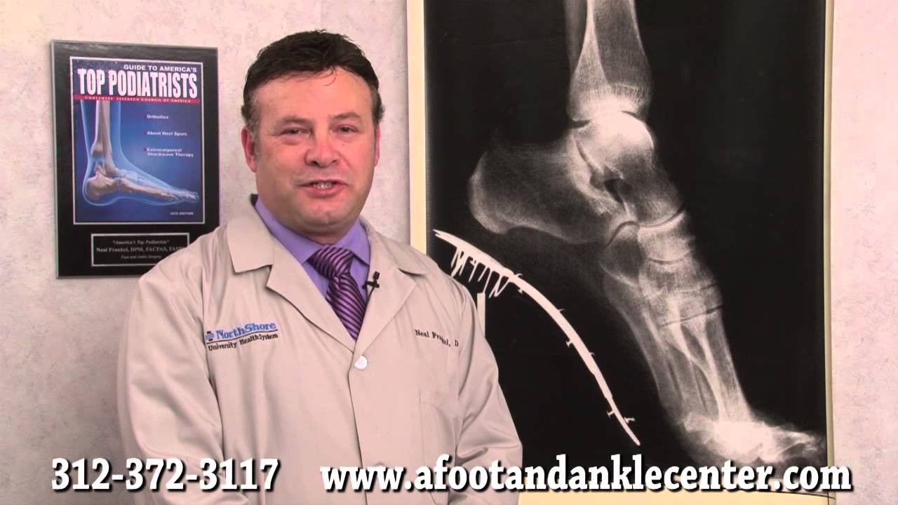 Surgical Revision For Foot Surgery - Chicago, Lincolnwood, Oak Brook ...