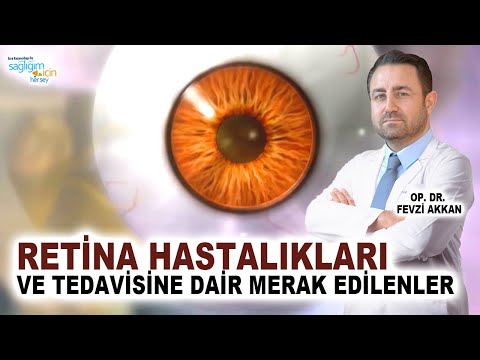 Retina Hastalıkları ve Tedavisine Dair Merak Edilenler