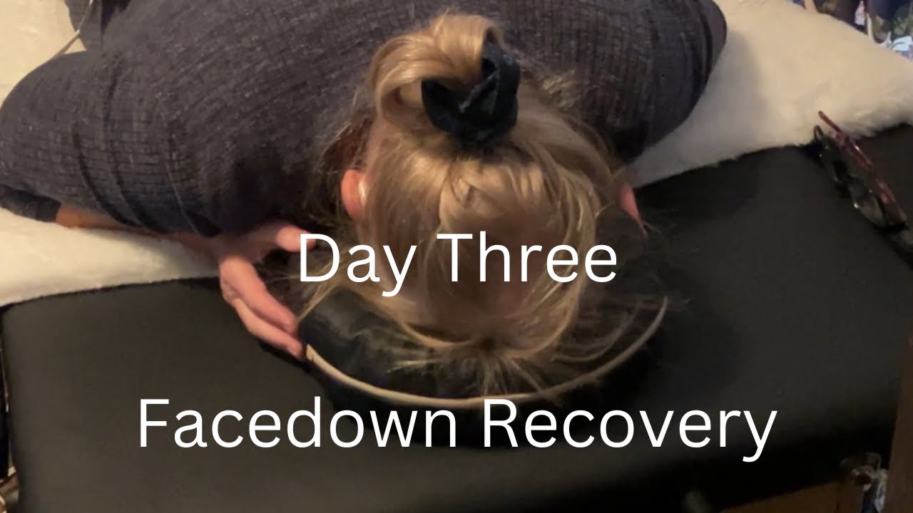 Macular Hole surgery: Facedown Recovery After Eye Surgery - YouTube