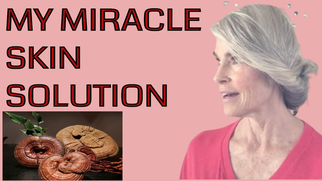 My Miracle Skin Solution - YouTube