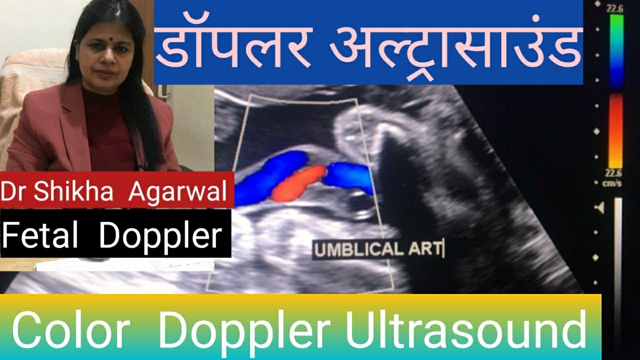 Color Doppler ultrasound /डॉपलर अल्ट्रासाउंड /Arterial blockage /Fetal ...