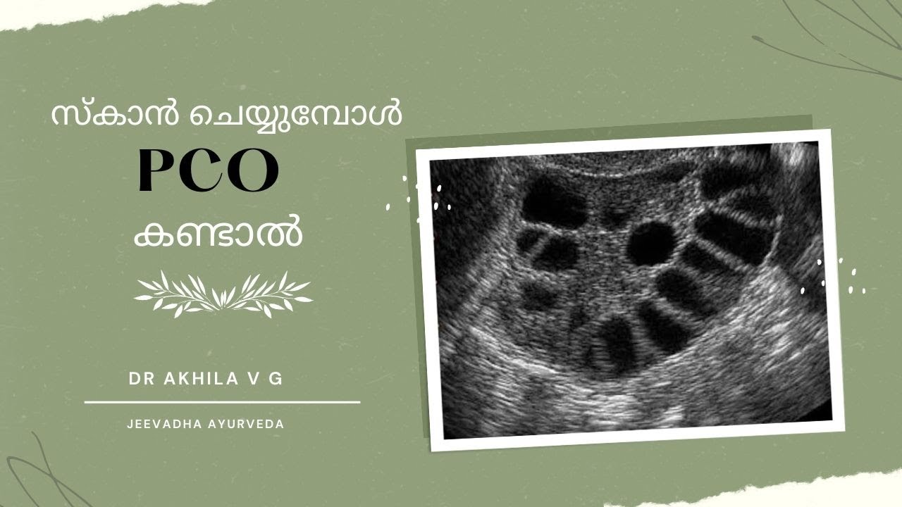 സ്കാൻ ചെയ്യുമ്പോൾ ‘PCO’ കണ്ടാൽ @jeevadhaayurveda |PCOD & Scan| Dr ...