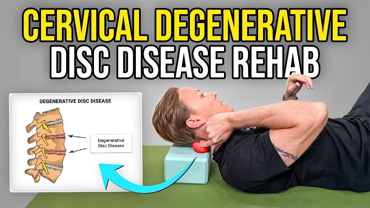 4 Exercises for Cervical Degenerative Disc Disease - YouTube