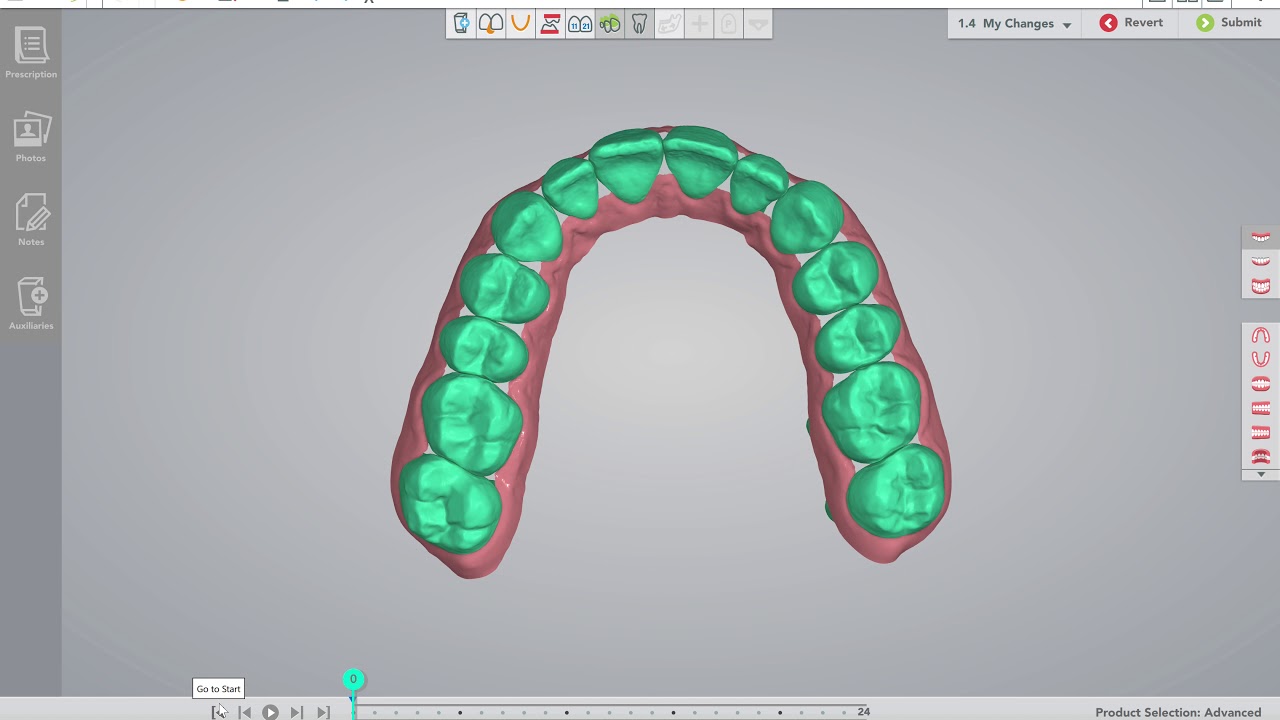 Learn How to Perform the perfect treatment plan with Spark Aligners ...