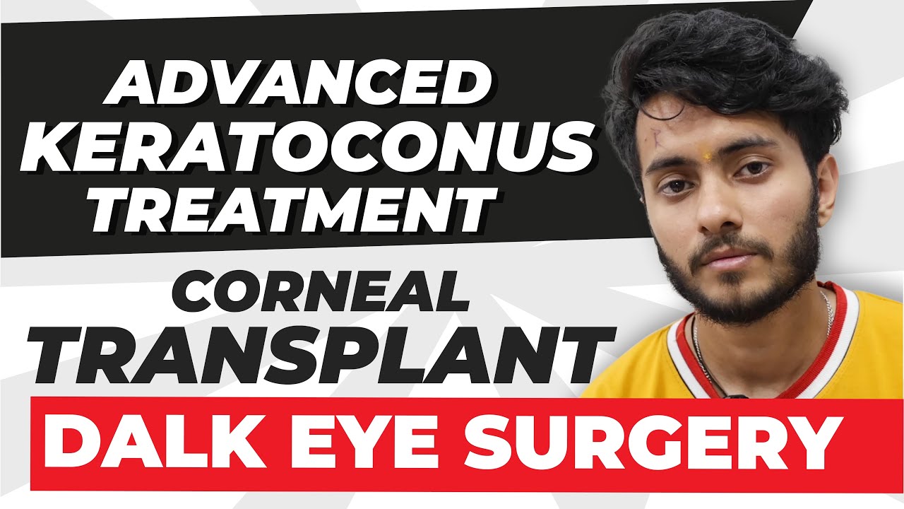 Corneal Transplant (DALK) for Advanced KERATOCONUS Treatment - Best ...
