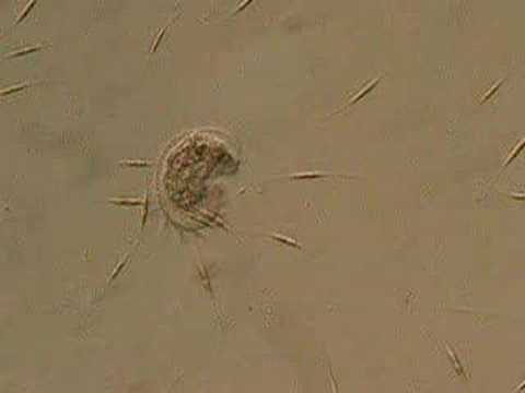 Cylindrotheca Diatoms And Ciliates Youtube