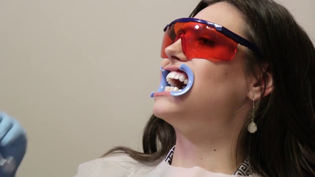 Polus Beyond Polus Advanced Power Whitening System REF 751 1,Rev A ...