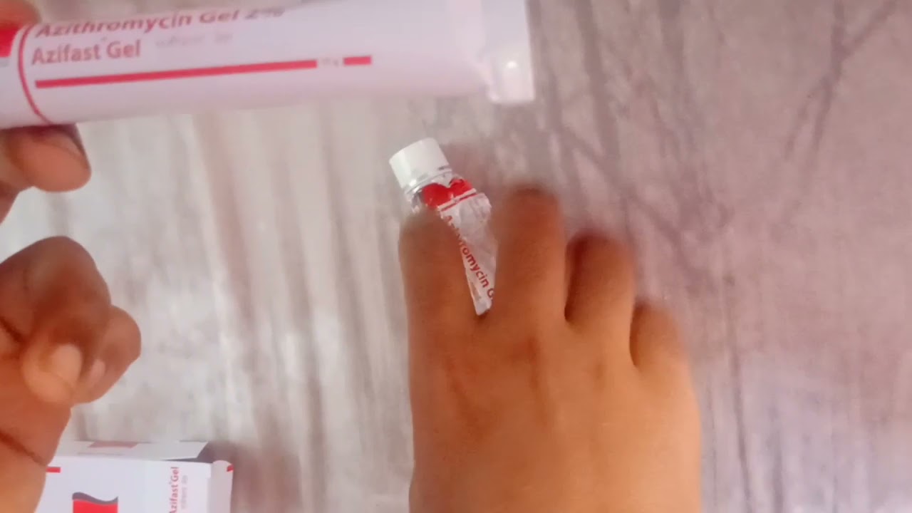 Pimples Treatment /Azithromycin Gel Review - YouTube