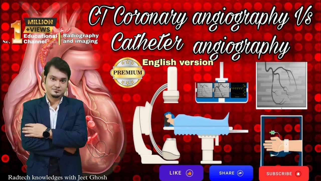 CT scan coronary angiography Vs Traditional catheter angiography # ...