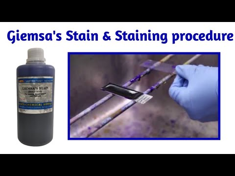 Giemsa stain and Giemsa staining procedure clearly explain in Hindi ...