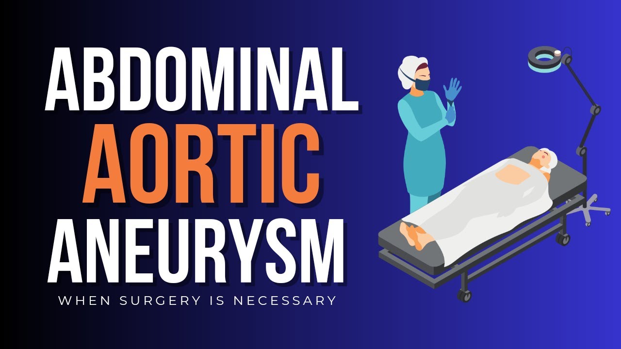 Abdominal Aortic Aneurysm Understanding When Surgery Is Necessary To