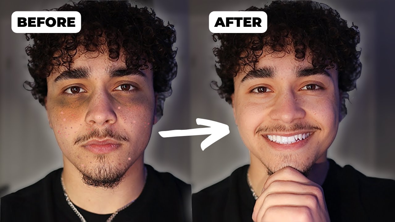 Want Clear Skin As A Guy? Do These 5 Things! - YouTube