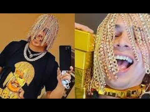 RAPPER Gets GOLD CHAINS Surgically IMPLANTED Into His SCALP - YouTube