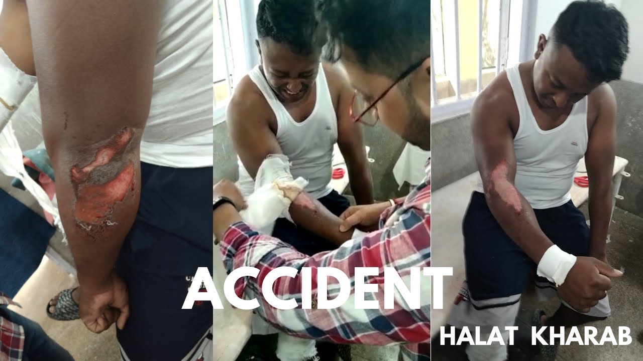 Dost Ka Accident Ho Gya😰 Bar Bar Bacha || Vlog 82 || Lama Dupchen - YouTube