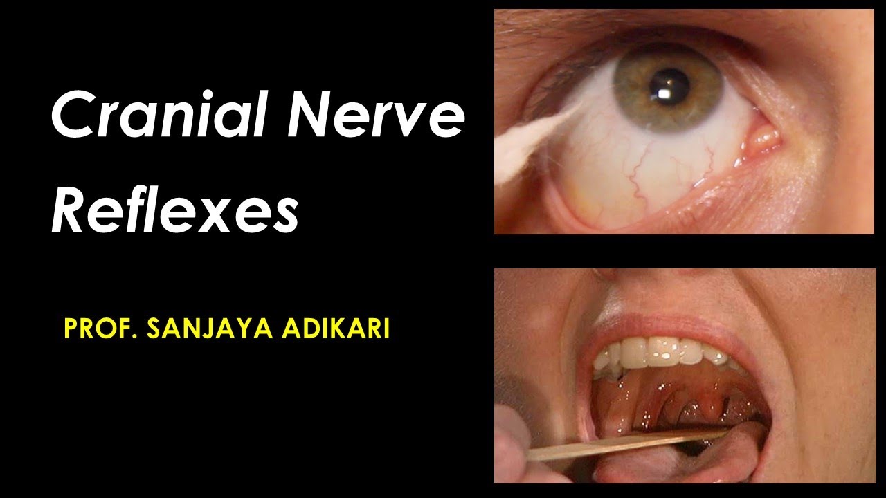 Cranial nerve reflexes - YouTube