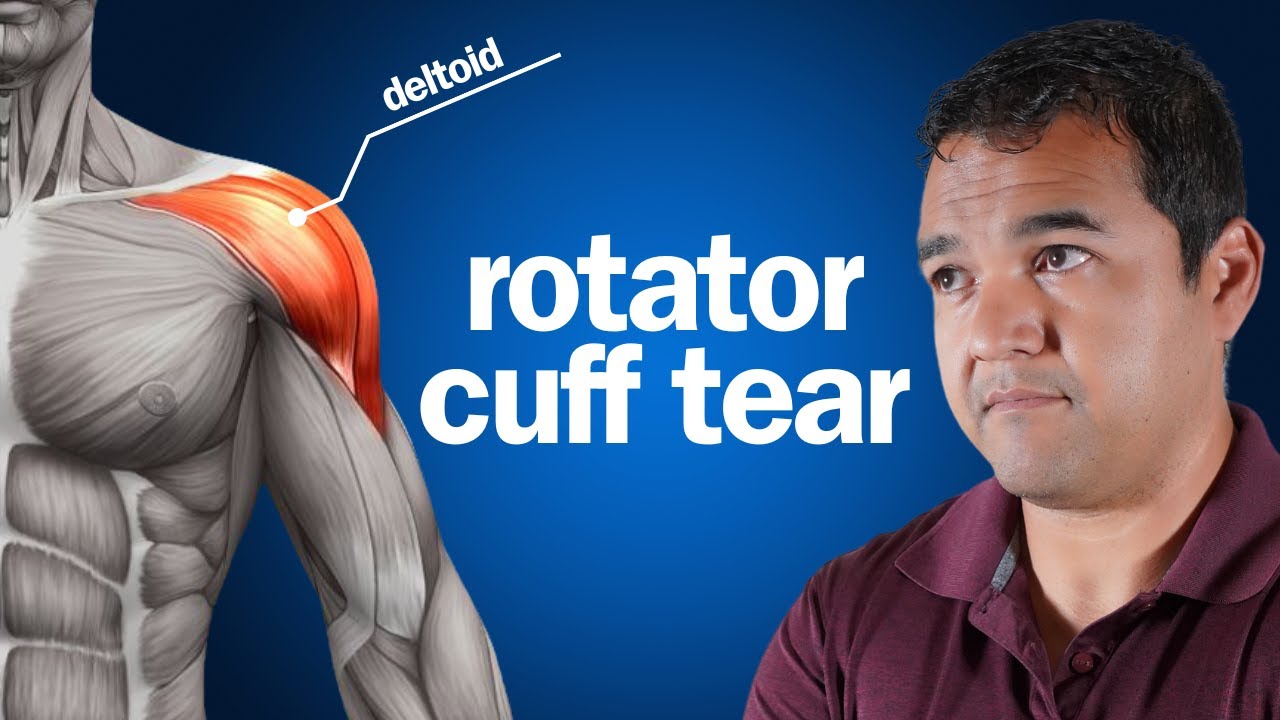 Should You Strengthen Your Deltoids to Help Heal a Torn Rotator Cuff ...
