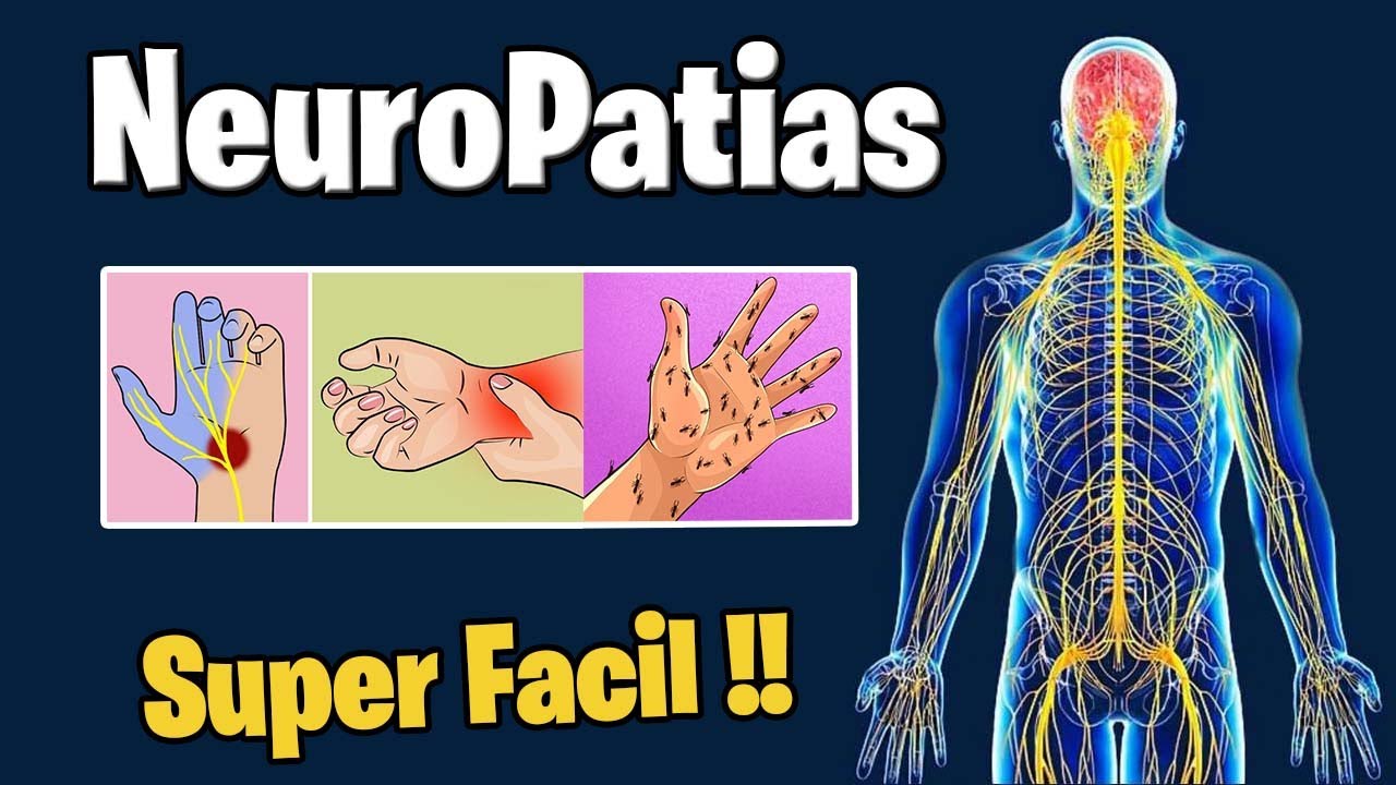 Cid Neuropatia Membros Inferiores - RETOEDU