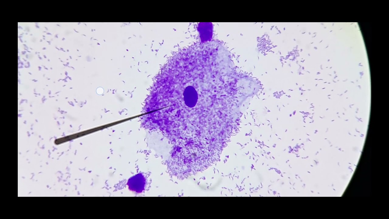 мобілункус #баквагіноз #mobiluncus - YouTube