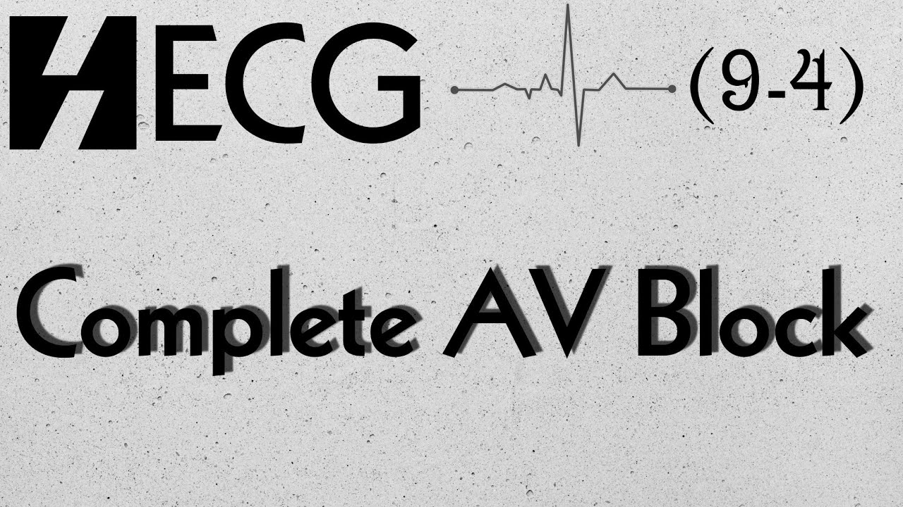 Complete AV Block ECG (9-4) - YouTube
