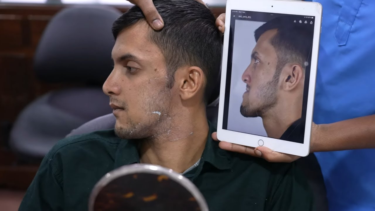 Plastic Surgery Changed this Boys face - New Face Transformation - YouTube