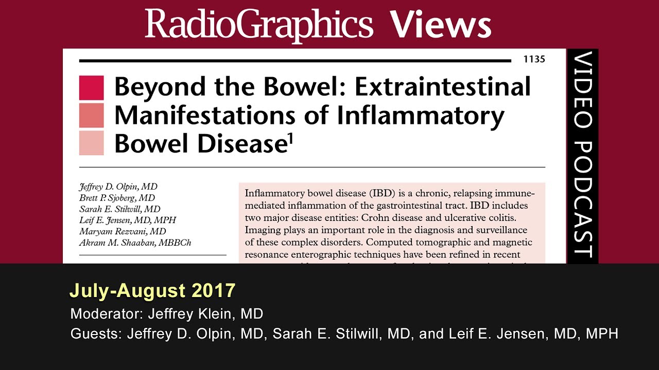 Beyond the Bowel: Extraintestinal Manifestations of Inflammatory Bowel ...