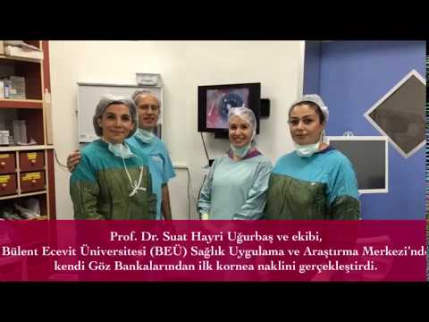 Prof. Dr. Suat Hayri Uğurbaş BEU Göz Bankasından İlk Kornea Naklini Gerçekleştirdi