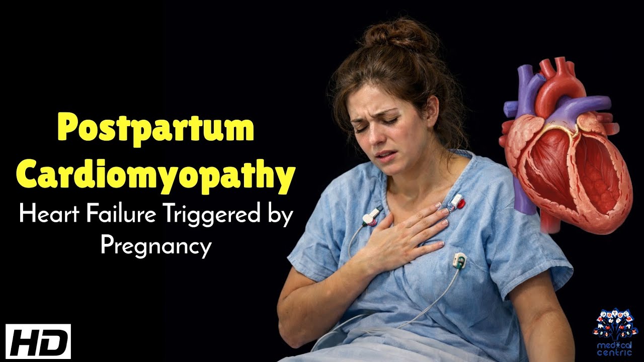 Postpartum Cardiomyopathy Heart Failure Triggered by Pregnancy ...