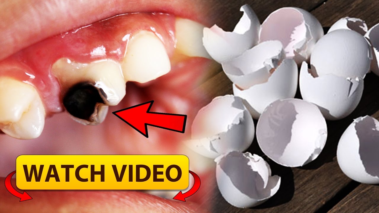 Nothing But Eggshells! you can Get Rid Of Tooth Cavities like Magic ...