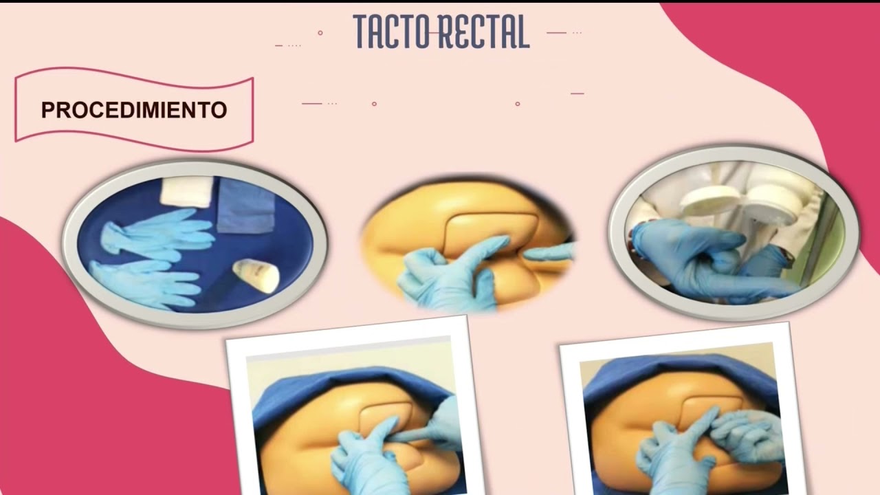 EXAMEN FÍSICO UROLÓGICO - TÉCNICA DEL TACTO RECTAL 👩🏻‍⚕️ - YouTube