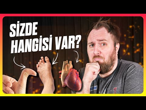 Bilmeden Sahip Olabileceğiniz 10 Anormal Özellik!