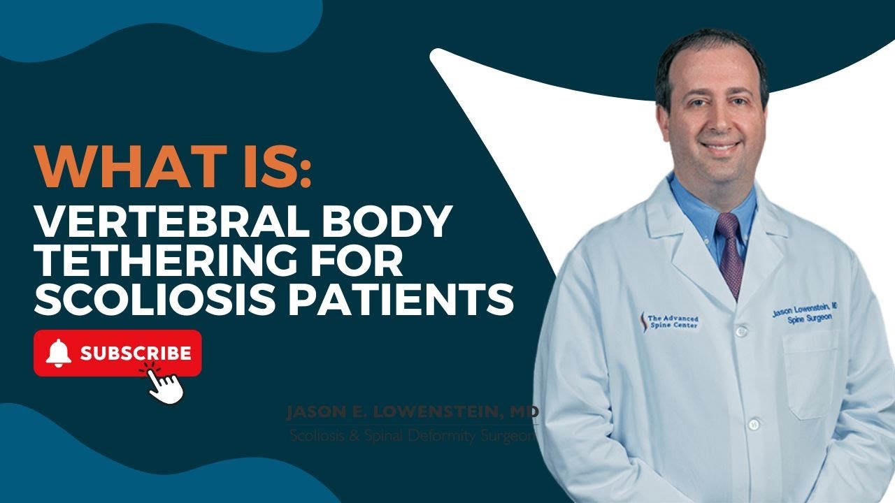 Scoliosis Treatment: Understanding Vertebral Body Tethering (VBT) | Dr ...