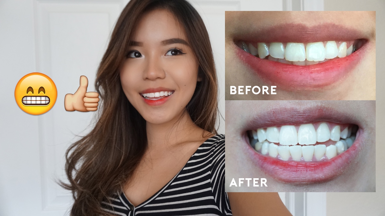 AT HOME TEETH WHITENING THAT 100% WORKS!! - YouTube