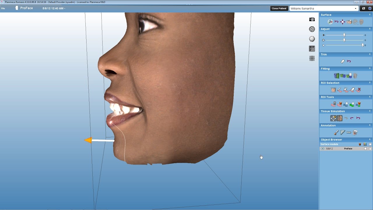 Planmeca ProFace Shaping tool - YouTube