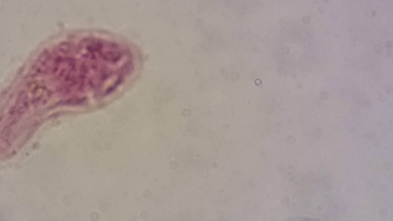 Fasciola Hepatica Miracidia