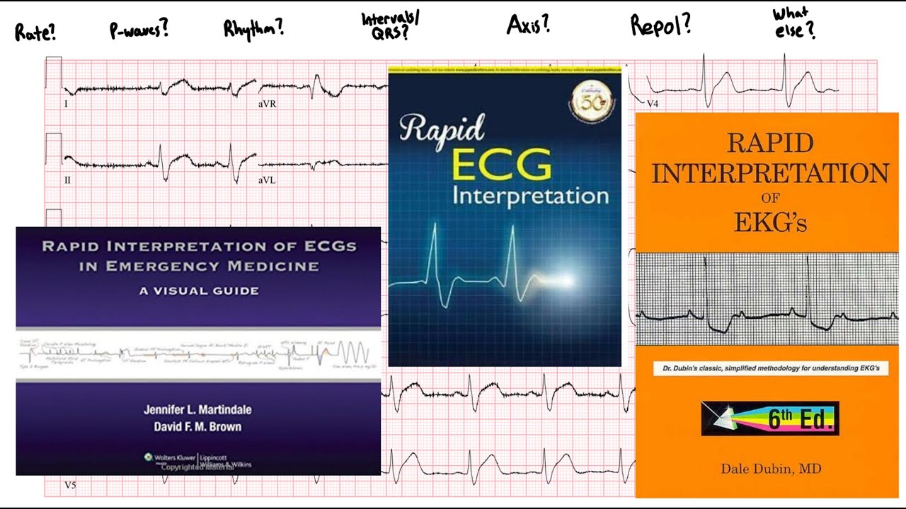 Intro: The 10 Second Triage ECG - YouTube