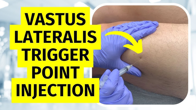 Vastus Lateralis Infant