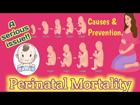 Perinatal Mortality (Causes & Prevention) by Dr. Sonia Tiwari. - YouTube
