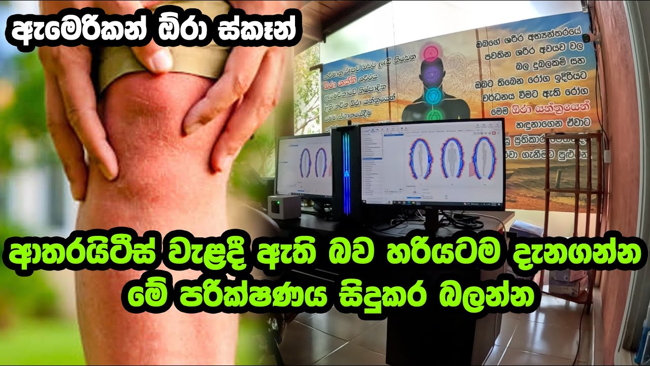 ආතරයිටීස් වැළදී ඇති බව හරියටම දැනගන්න මේ පරික්ෂණය සිදුකර බලන්න American ...