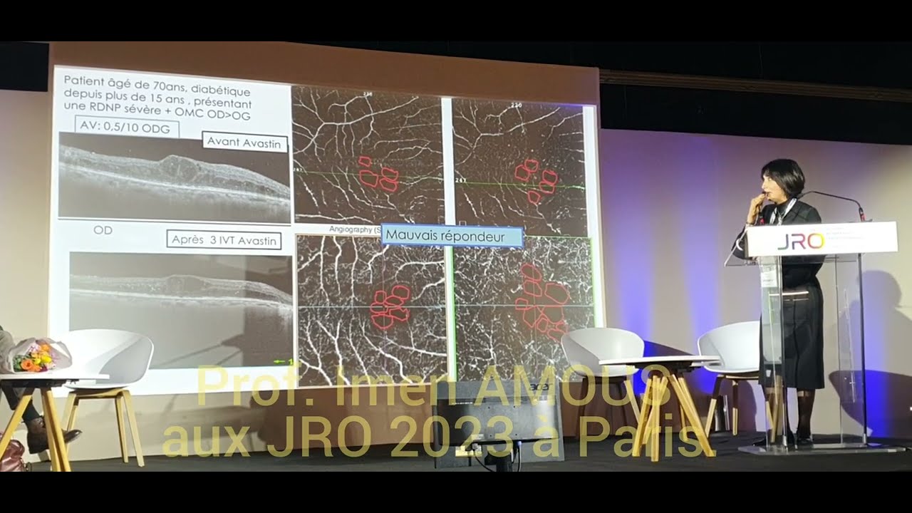 Imen AMOUS aux JRO 2023 - YouTube