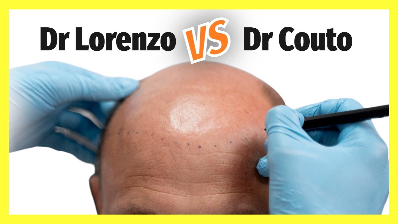 Dr. Lorenzo ⚡ Dr. Couto | Injerto Capilar Opiniones - YouTube