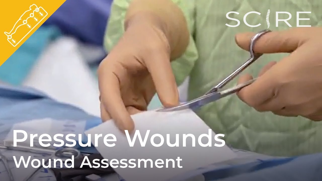 Pressure Wounds: Wound Assessment - YouTube