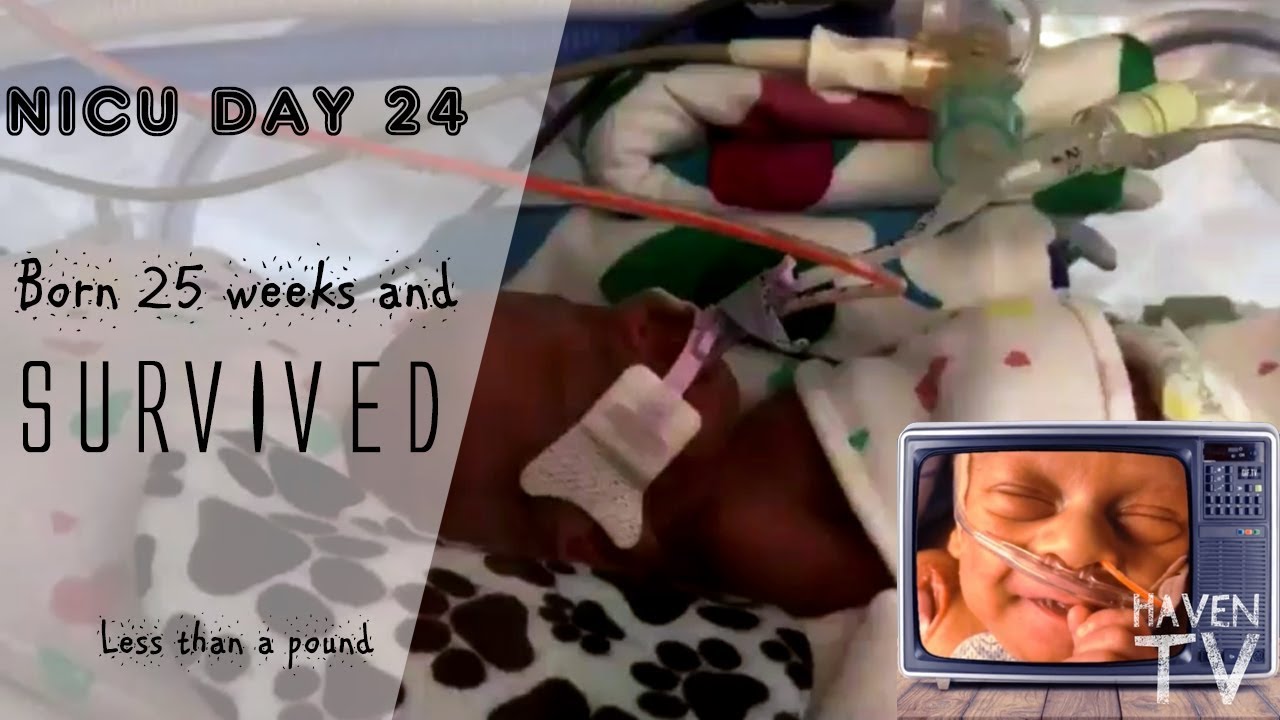 NICU Day 24: Micro Preemie Journey - Two Step Forward Three Steps Back ...