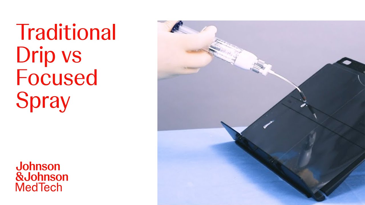 Traditional Drip vs. Focused Spray Method using VISTASEAL Fibrin ...